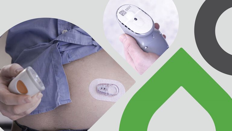 Dexcom ONE Children CGM System | Dexcom